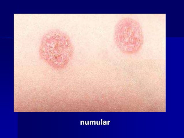 Ujud Kelainan Kulit.ppt