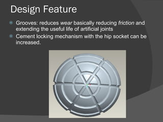 Total Hip Replacement | PPT