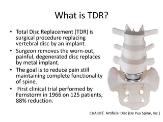 Spinal Disc Implant | PPT