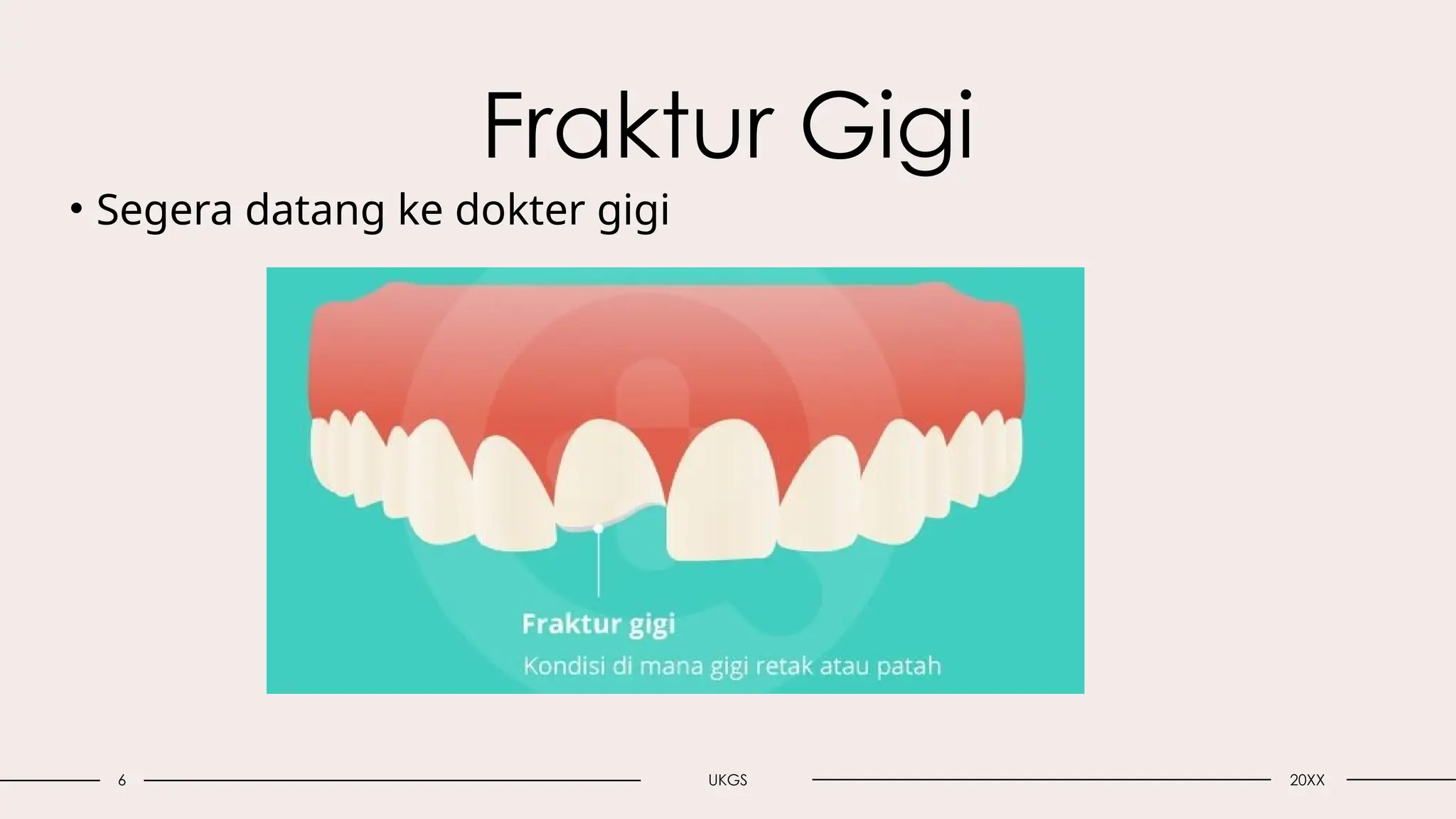 MATERI PENYULUHAN KESEHATAN UKGS (1).pptx