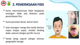 ukkrespi2024_PNAA_DIAGNOSIS & KLASIFIKASI_JUN.pptx