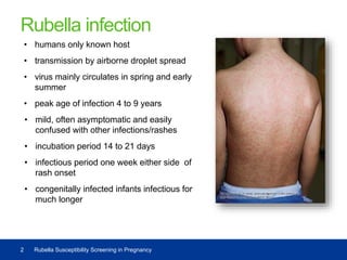 Rubella susceptibility | PDF