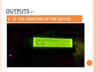 Heart Attack Detection VIA HEART Beat Monitor System | PPT