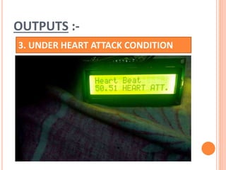 Heart Attack Detection VIA HEART Beat Monitor System | PPTX