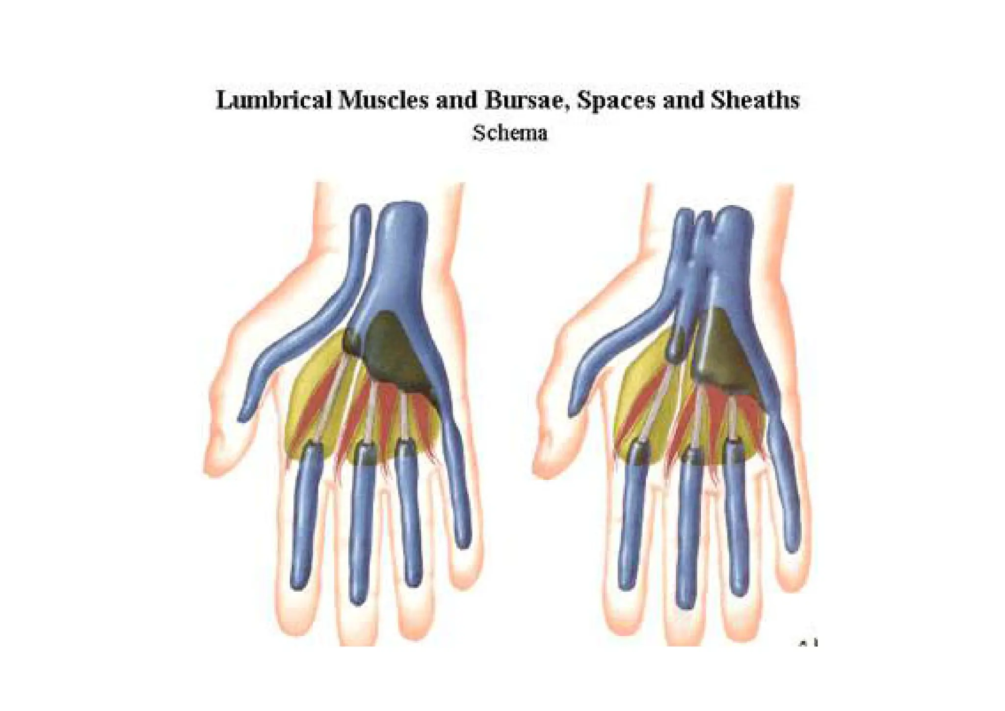 UL-fascial spaces in palm upper limb topic in anatomy (1).pdf