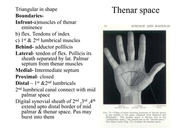UL-fascial spaces in palm upper limb topic in anatomy (1).pdf