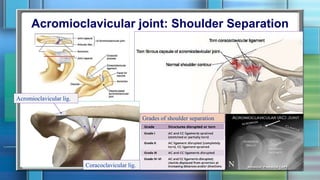 Shoulder Region | PPTX
