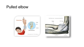 Principle of osteology upper limbs anatomy | PPT