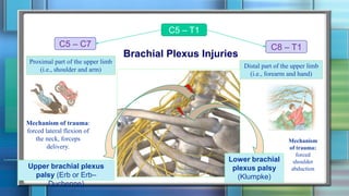 Brachial Plexus | PDF