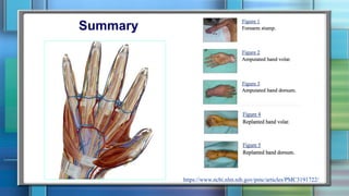 Hand and Wrist | PDF