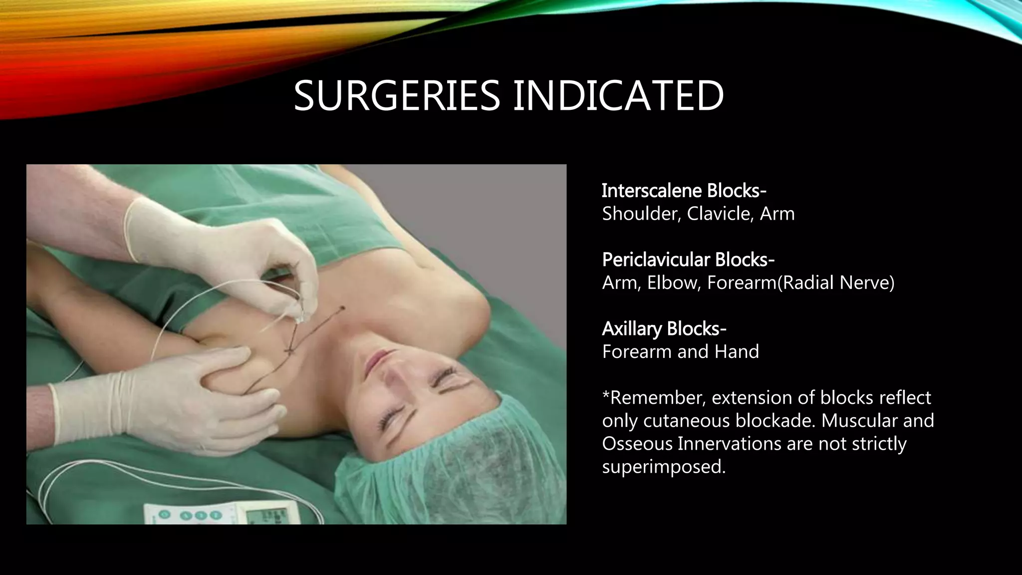 Regional Blocks of the Upper Limb and Thorax RRT | PPTX