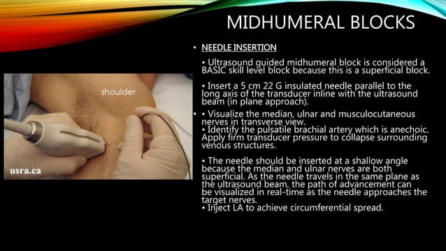 Regional Blocks of the Upper Limb and Thorax RRT | PPTX | Death, Injury, or Military Conflict ...