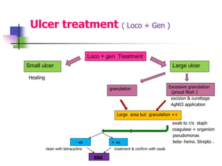 Ulcer | PPT