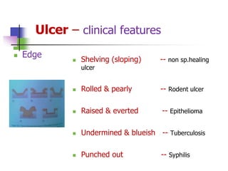 Ulcer | PPTX