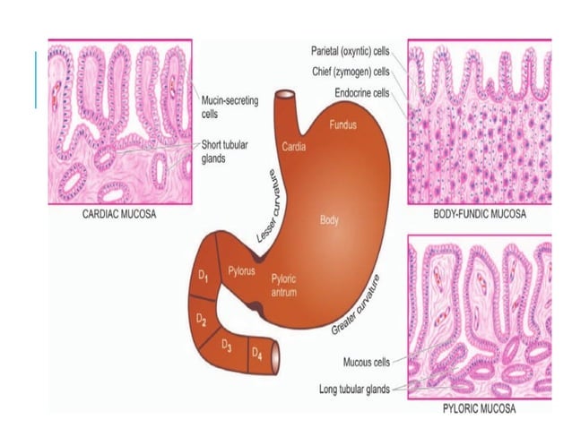 Etiology and Pathogenesis of Peptic Ulcer | PPT | Digestive Disorders ...