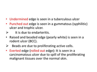 ulcer-190501174026.pdf
