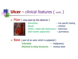 Ulcer by Dr.Prashant patil | PPTX