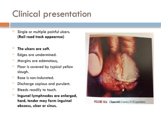 Ulcer ppt by the surgery department of hospital | PPTX