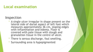 Ulcer ppt that deals with clinical significance of ulcer | PPTX