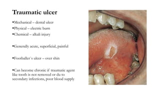 Ulcer (2) | PPTX