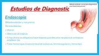Ulcera gastrica | PPTX