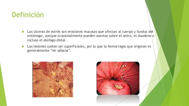 Ulcera por estres