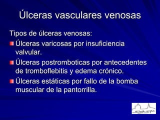 Ulceras vasculares | PDF