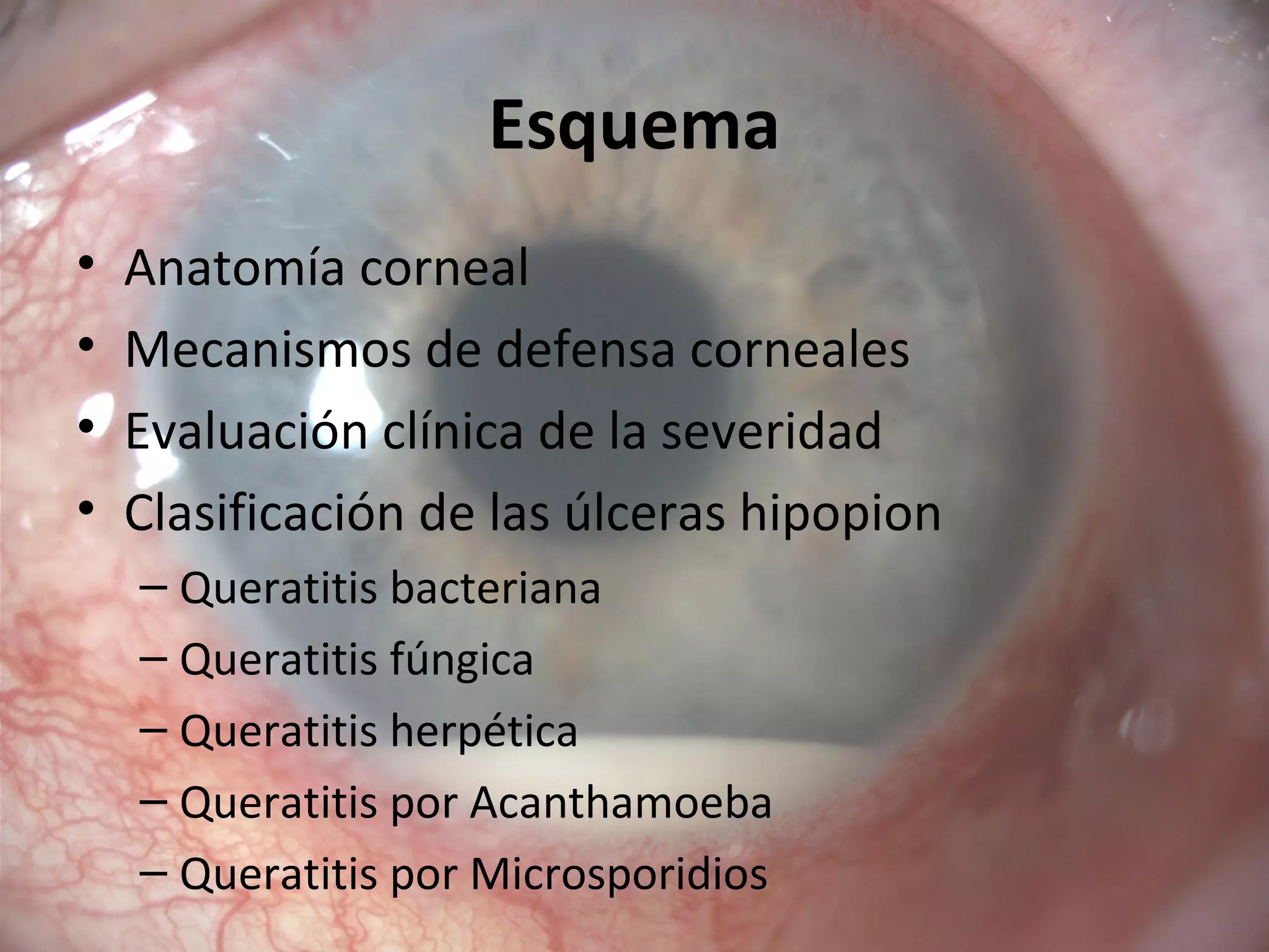Ulceras corneales | PPT