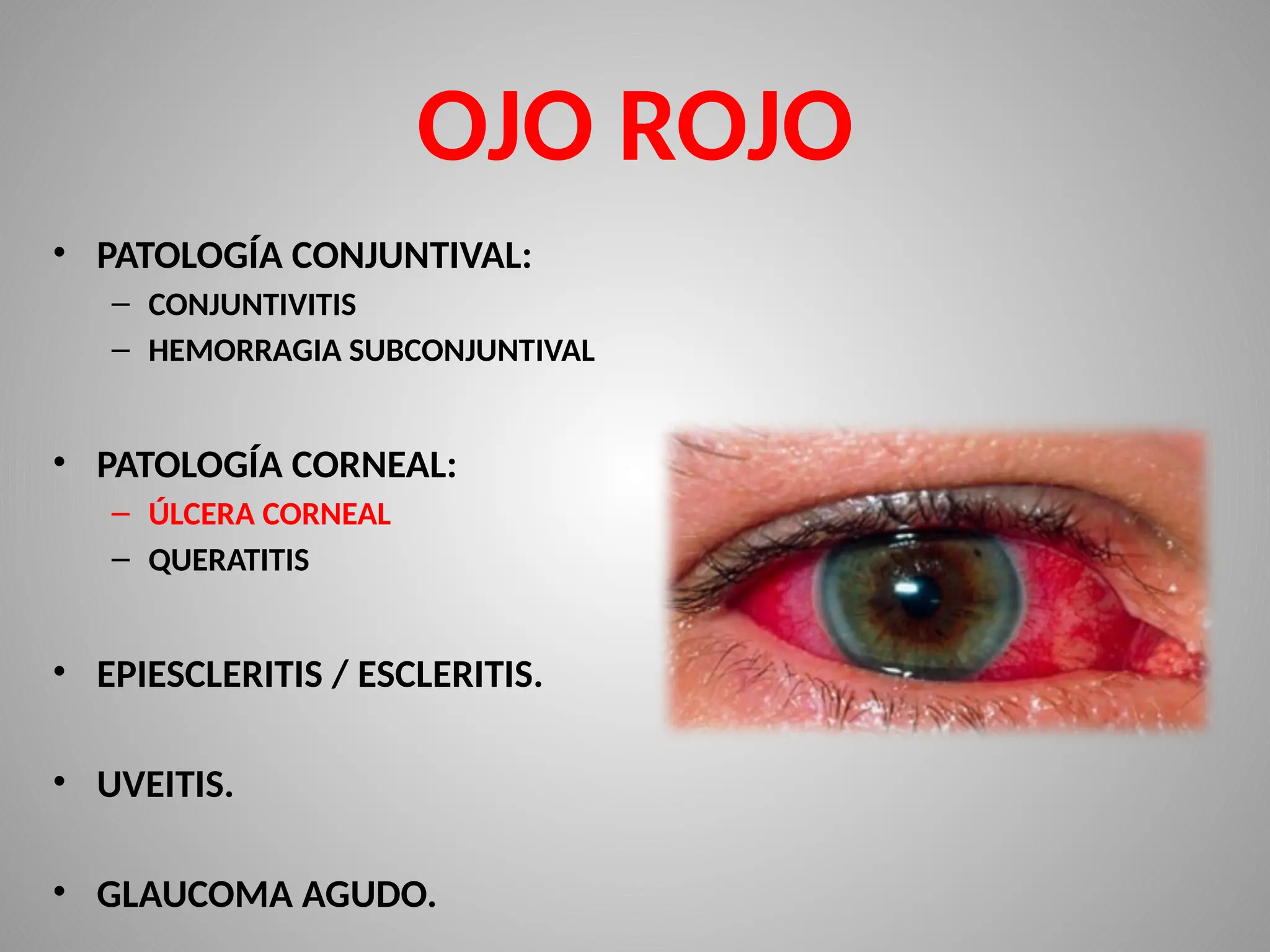 ulceras corneales oftalmologia. urgencia .ppx
