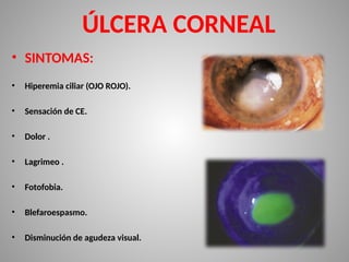 ulceras corneales oftalmologia. urgencia .ppx