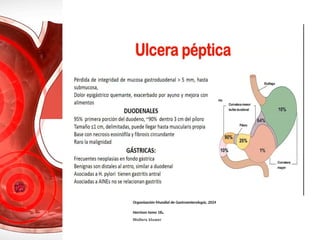 ULCERAS PEPTICAS.pptxgastricaoduodenalgas | PPTX