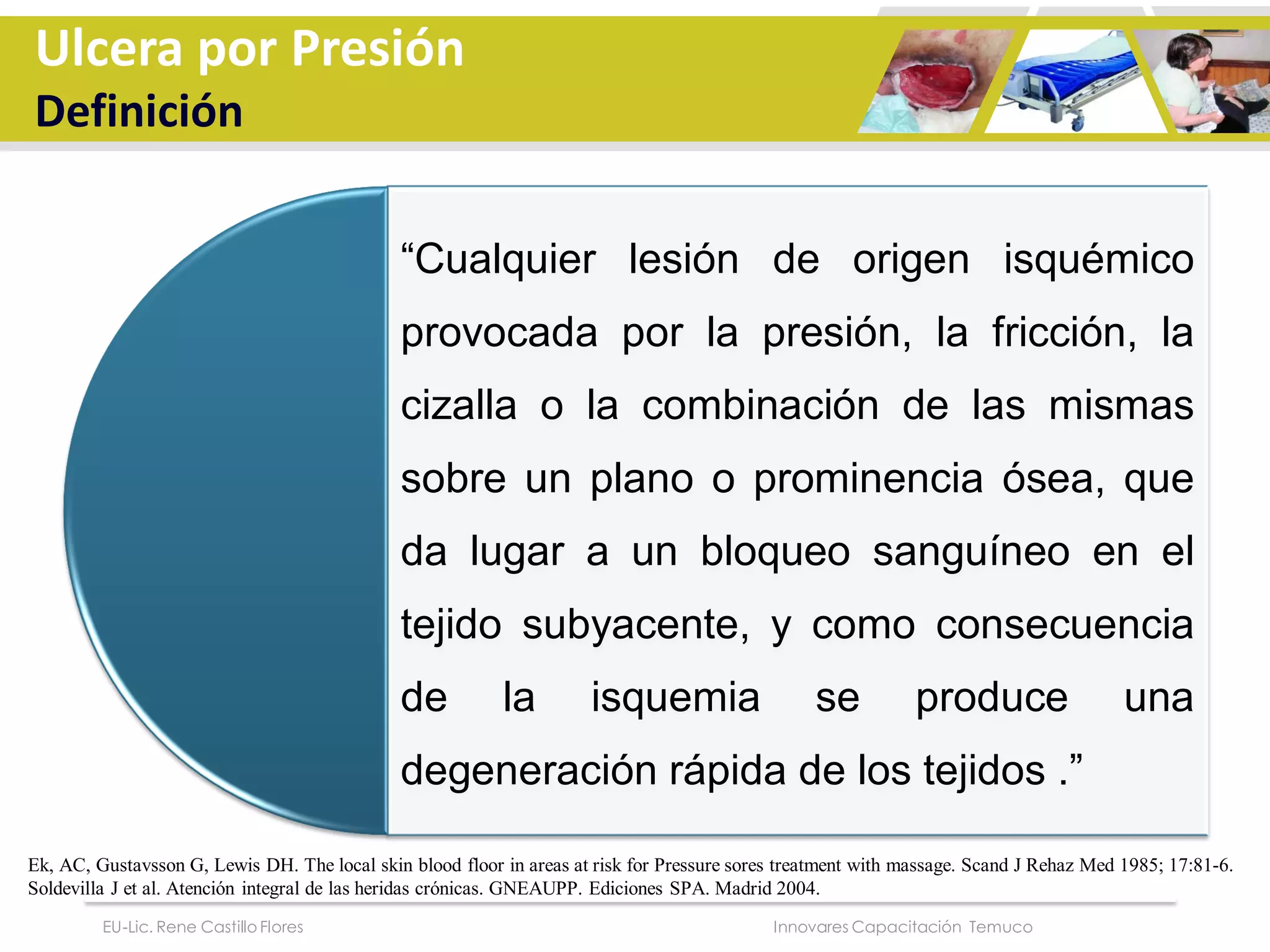 Prevención en Ulceras por Presión 2010 rene castillo flores | PDF
