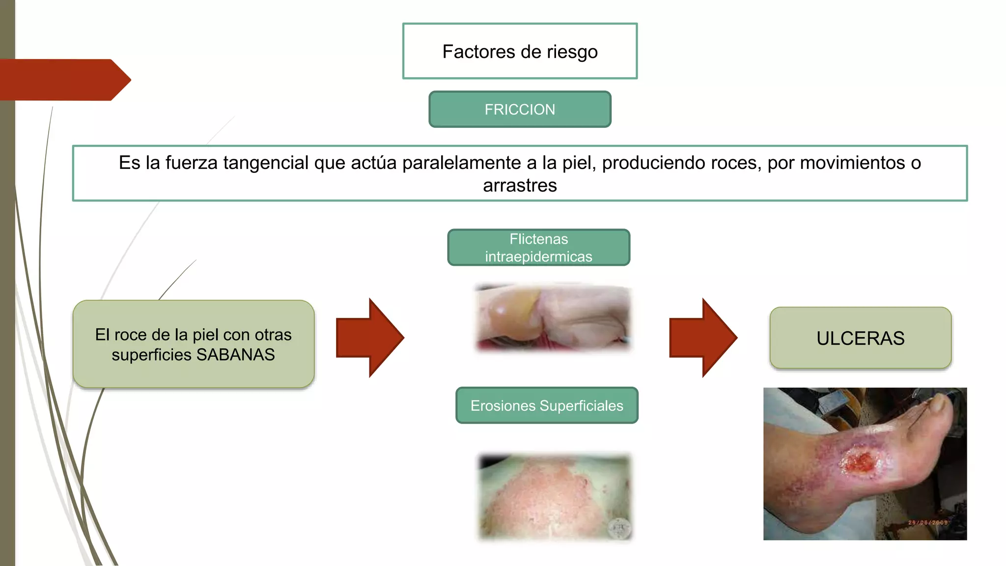 ulceras por precion.pptx1.pptx