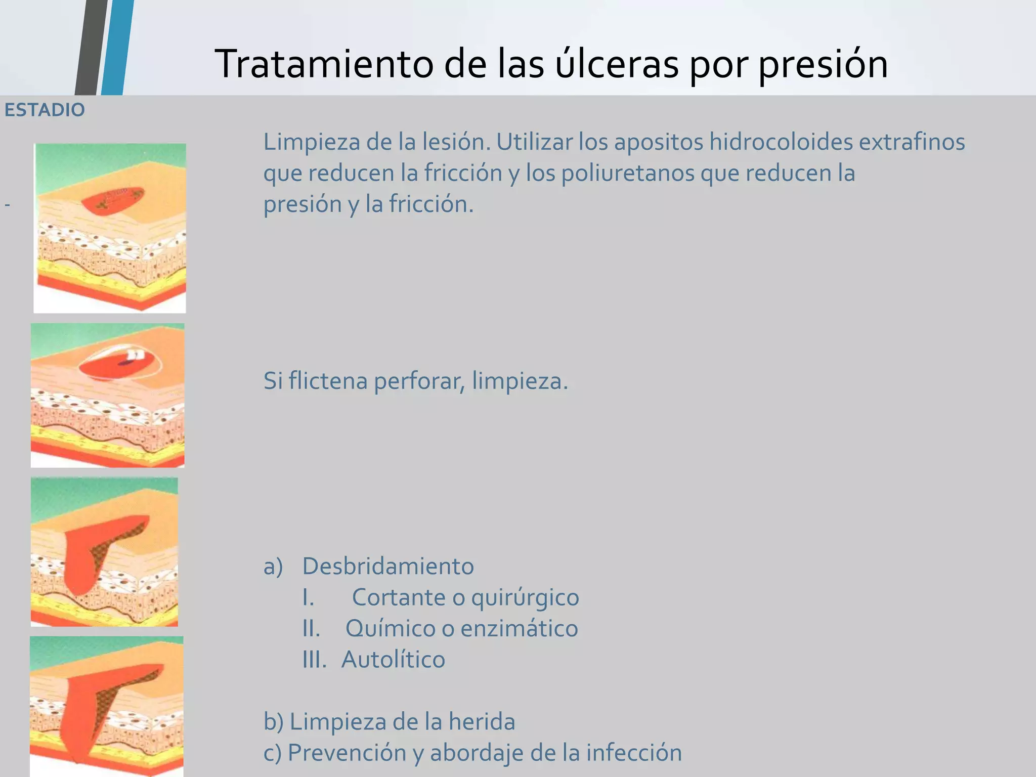 Ulceras por presión | PPTX