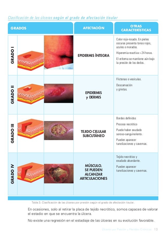 Ulceras por presion y heridas cronicas