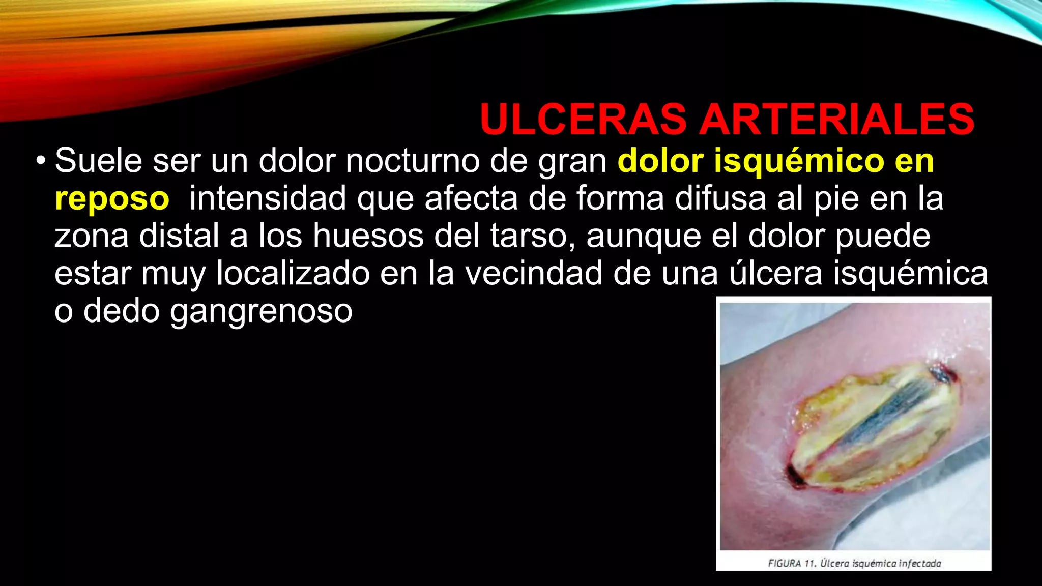 Ulceras vasculares CARLOS MATOS | PPT