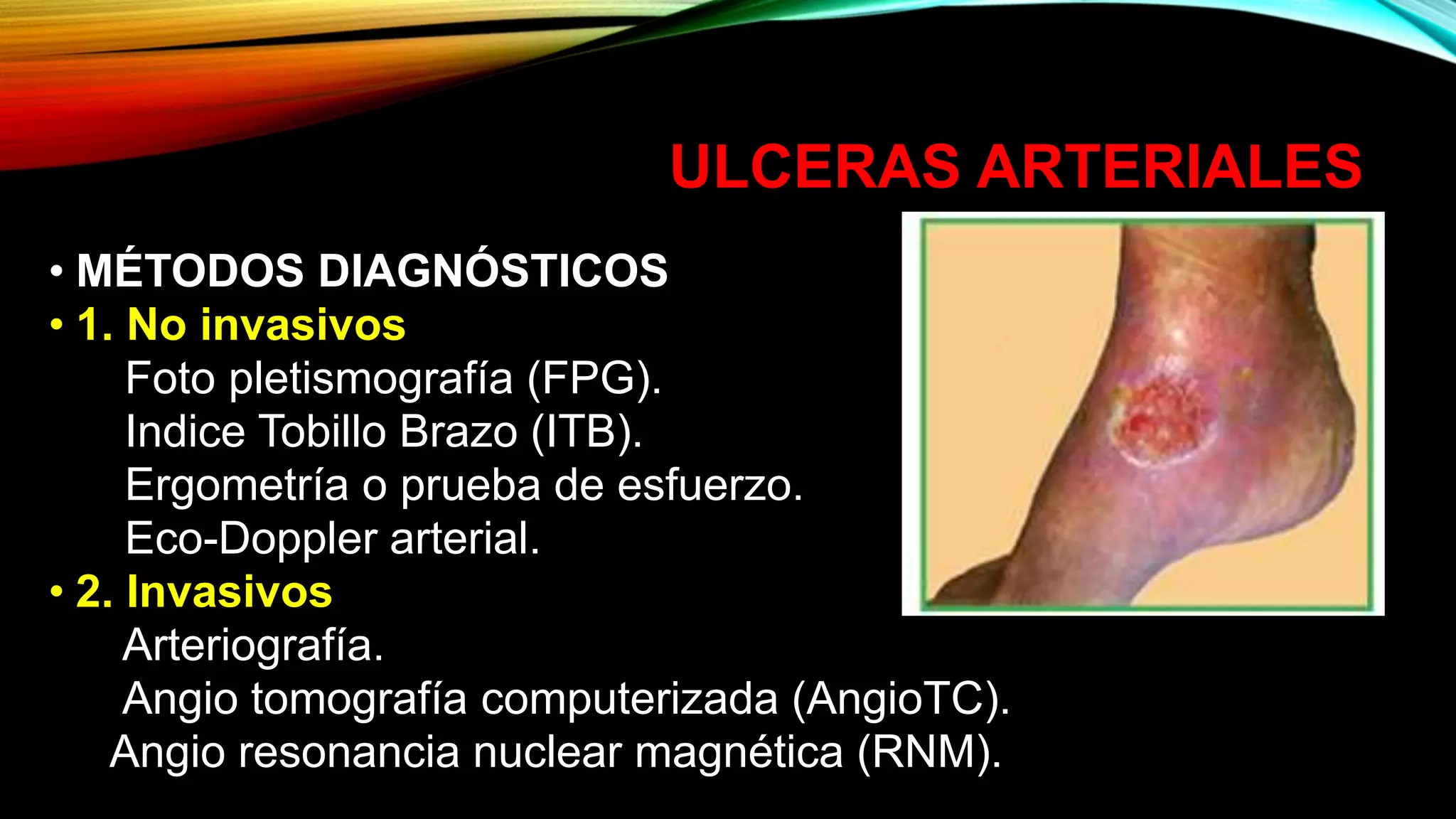 Ulceras vasculares CARLOS MATOS | PPT