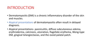 Ulcerated lobular panniculitis.pptx