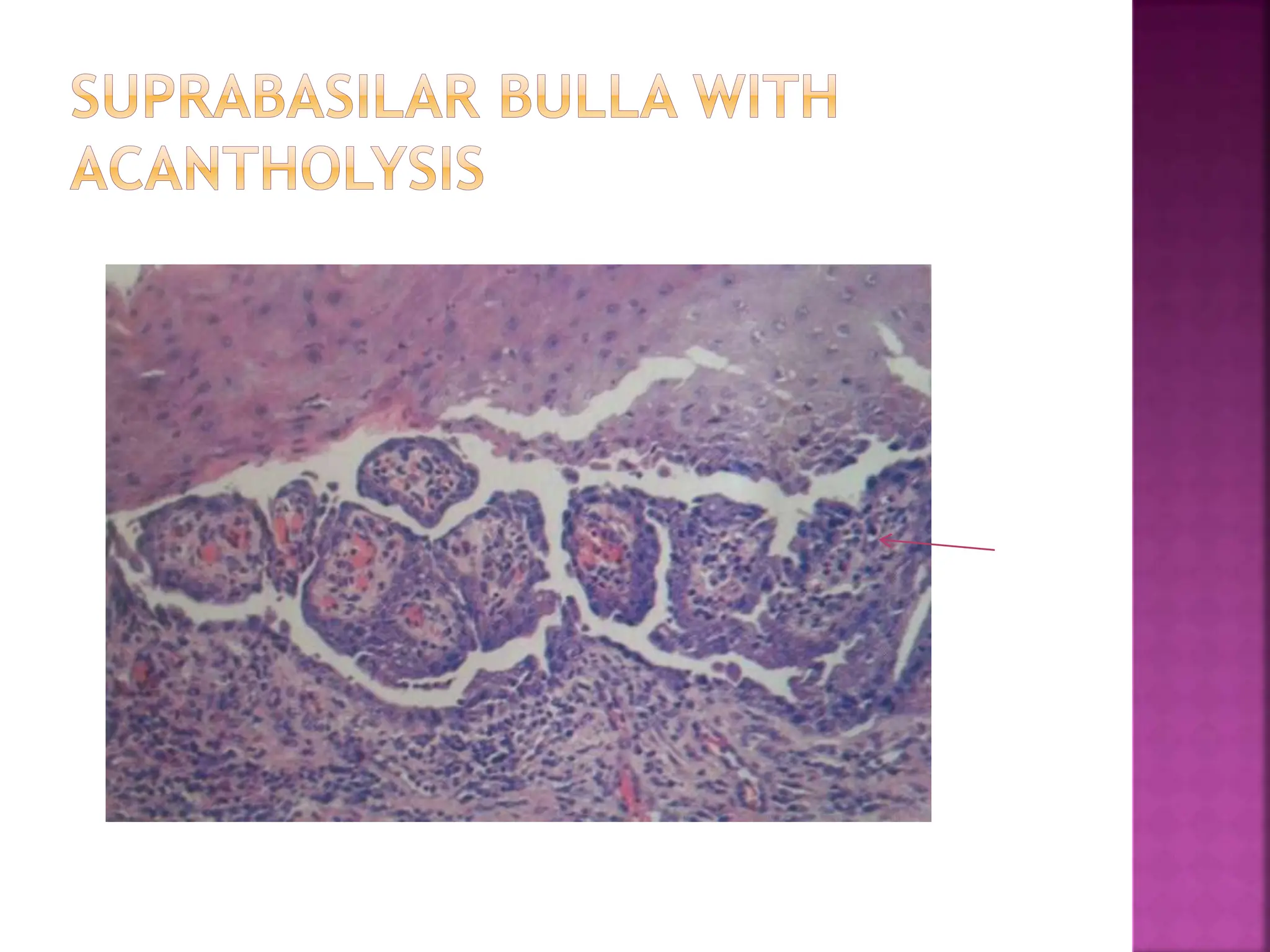 ULCERATIVE AND VESICULO BULLOUS LESIONS.pptx