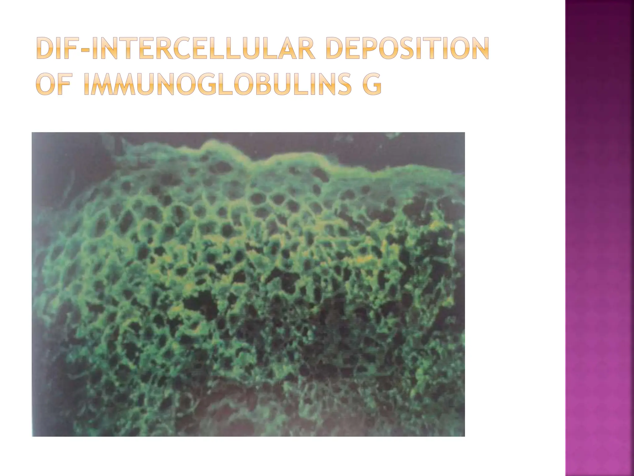 ULCERATIVE AND VESICULO BULLOUS LESIONS.pptx