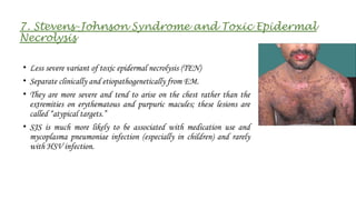 ULCERATIVE AND VESICULOBULLOUS LESIONS OF THE ORAL CAVITY.pptx