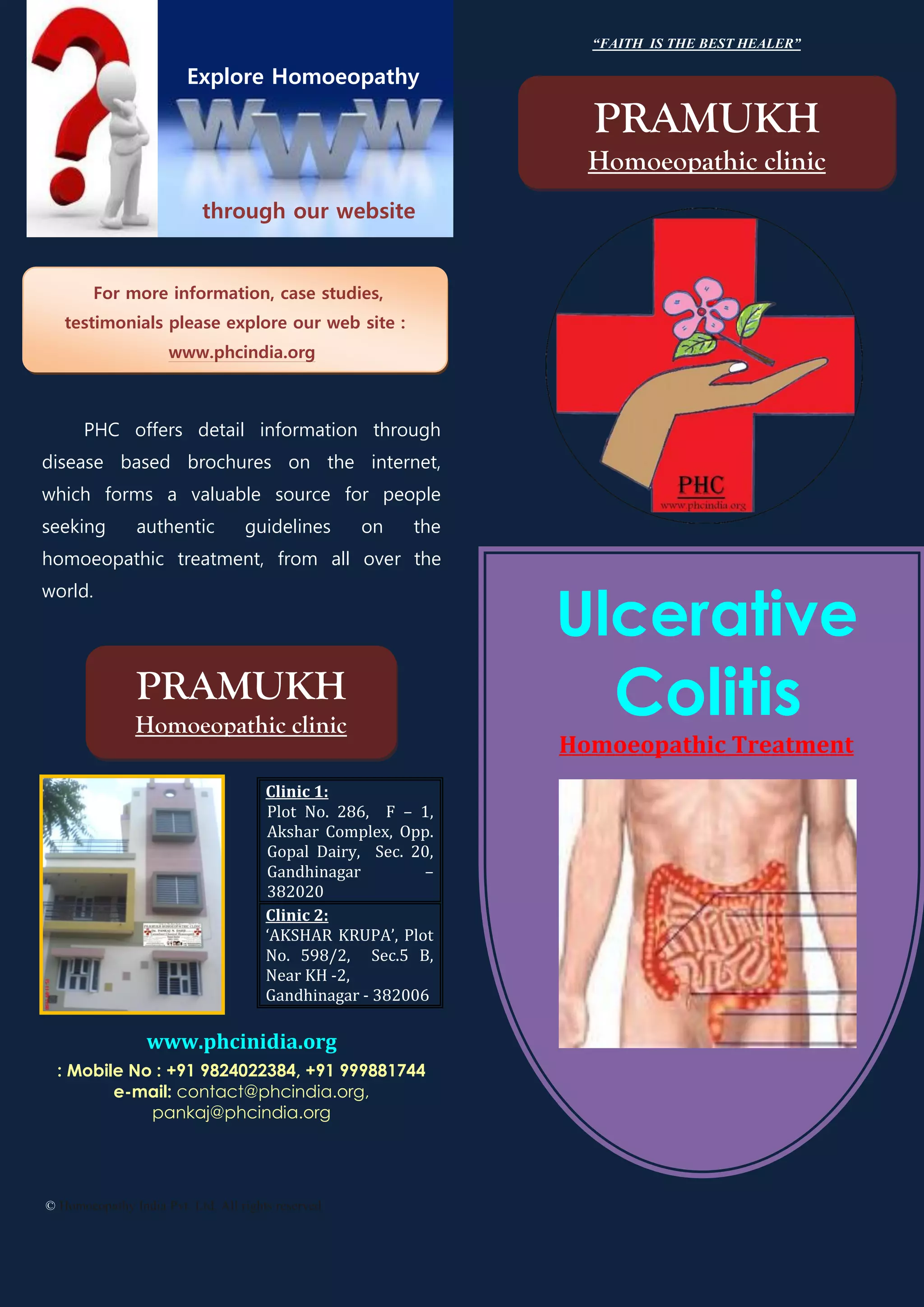 Ulcerative colitis | PDF