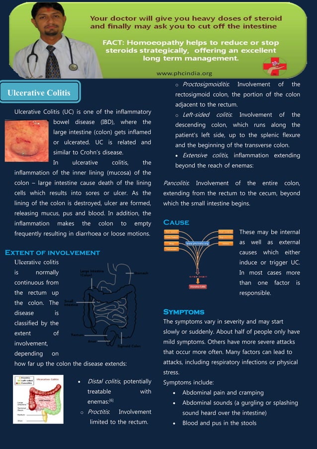 Ulcerative colitis | PDF