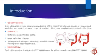 Ulcerative colitis | PPTX