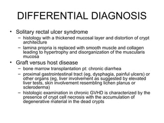 Ulcerative colitis | PPT