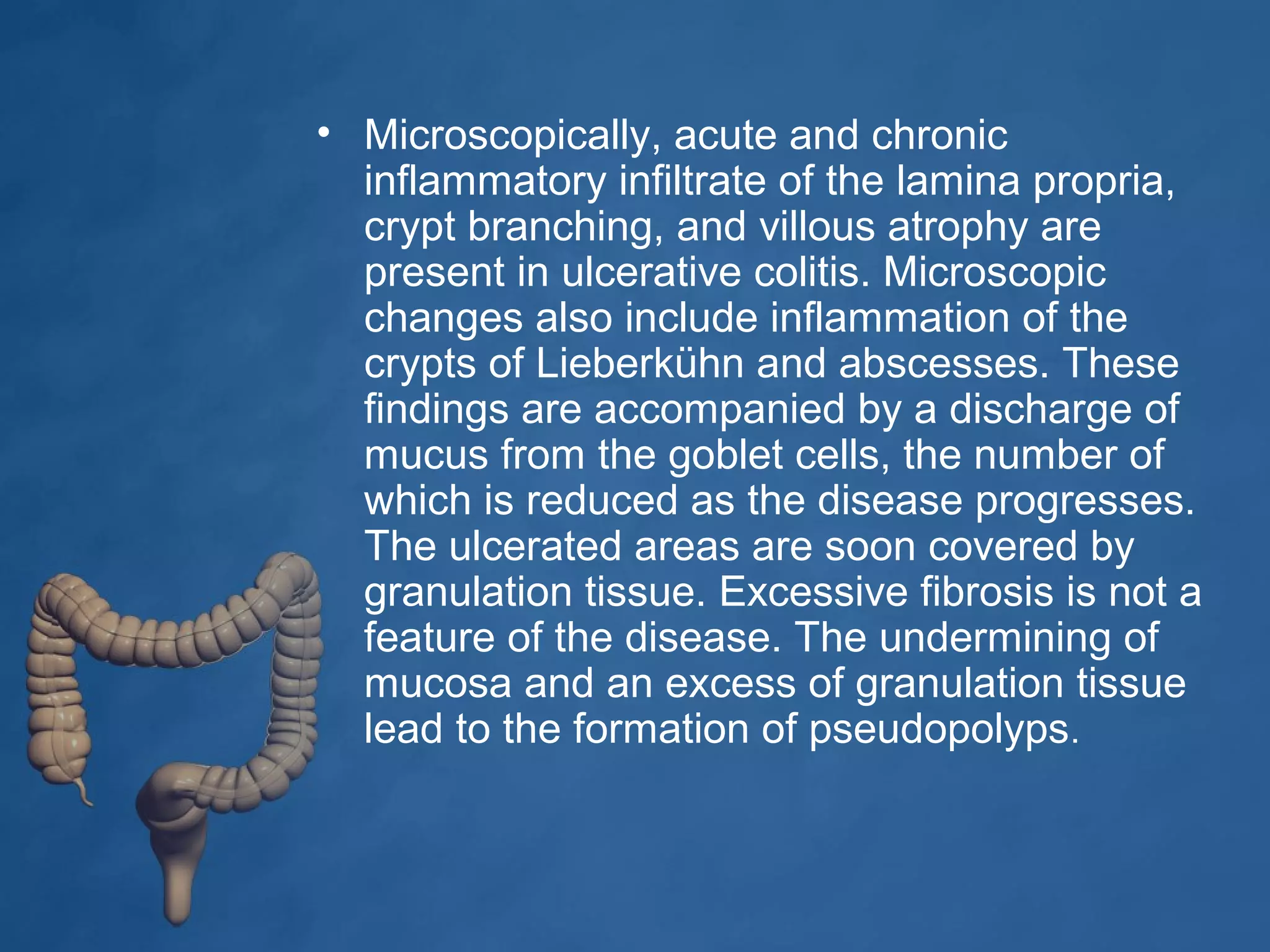 Ulcerative colitis | PPT
