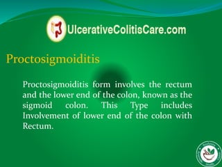 Ulcerative colitis | PPT