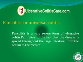 Ulcerative colitis | PPT
