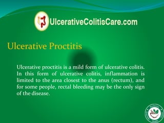 Ulcerative colitis | PPT
