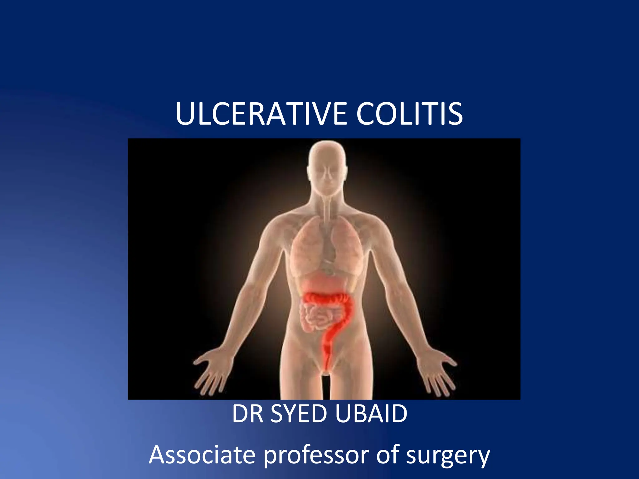ulcerativecolitis-170323180448 slide lecture | PPTX